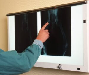 OFA X-Rays - https://lacrosseanimalhospitalva.com